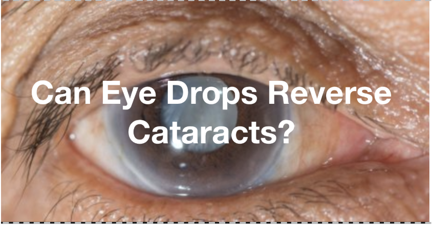 Can Lanosterol eye drops reverse cataracts? - Healing The Eye